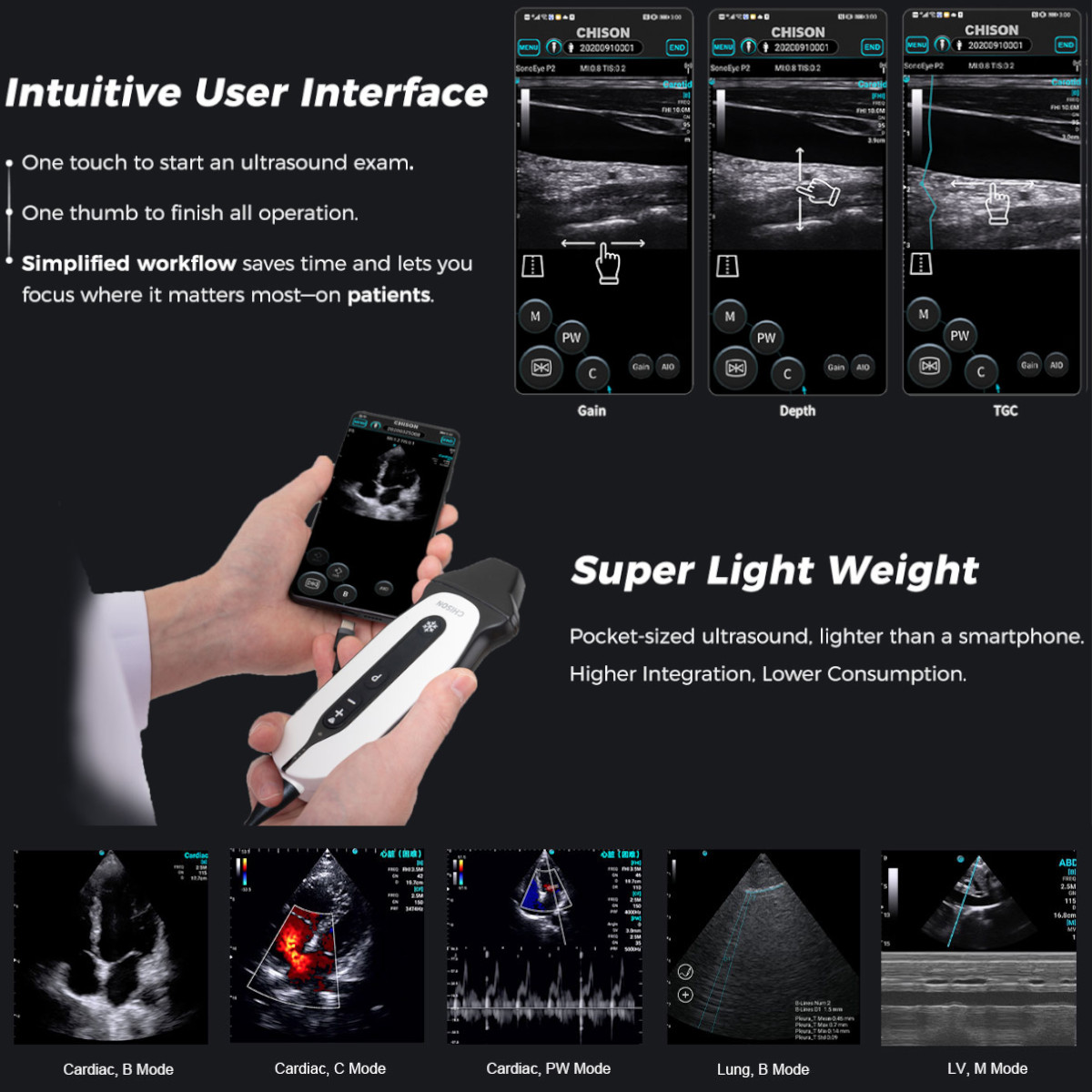 Ecograf ultraportabil SonoEye P3 - Sonda Phase Array 3.0 MHz, Ecografe doppler, alb/negru ...